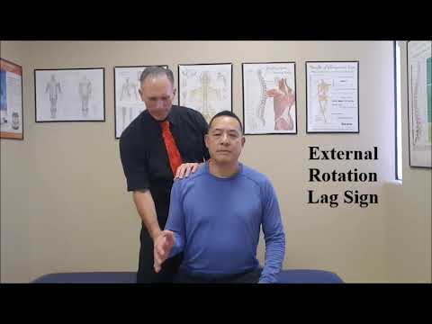 External Rotation Lag Sign - YouTube