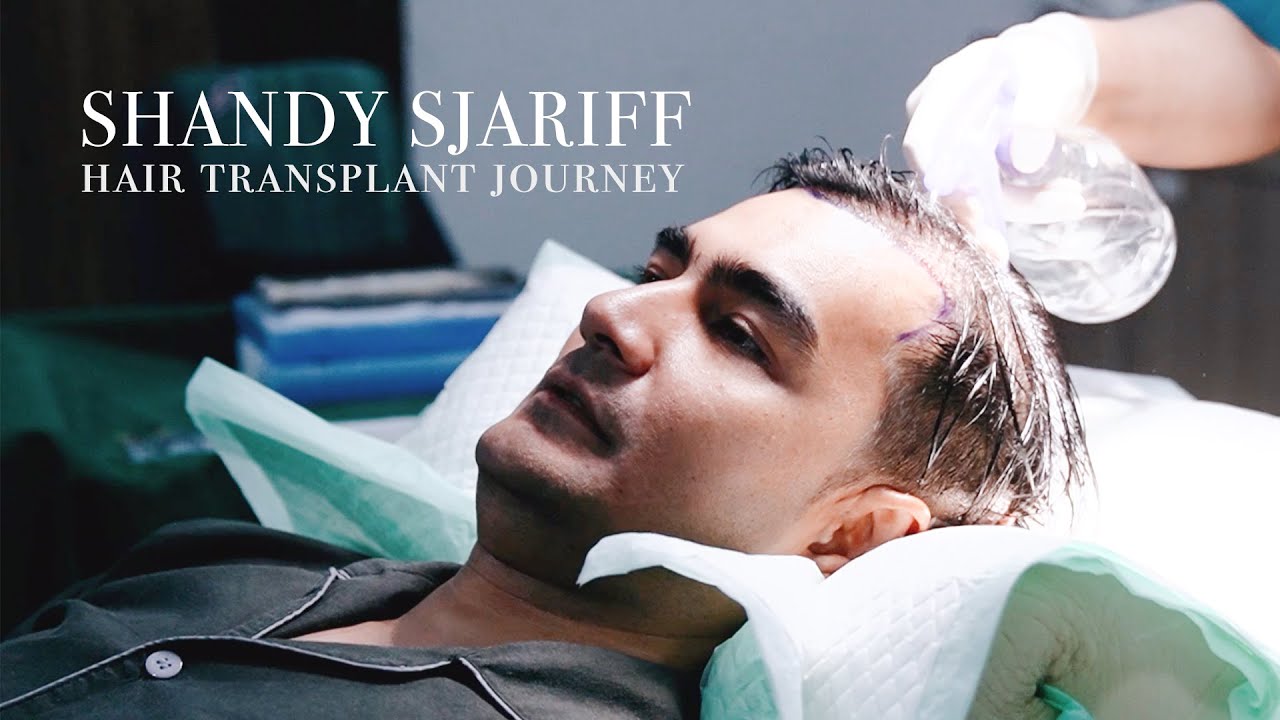 Shandy Sjariff Hair Transplant Journey - YouTube