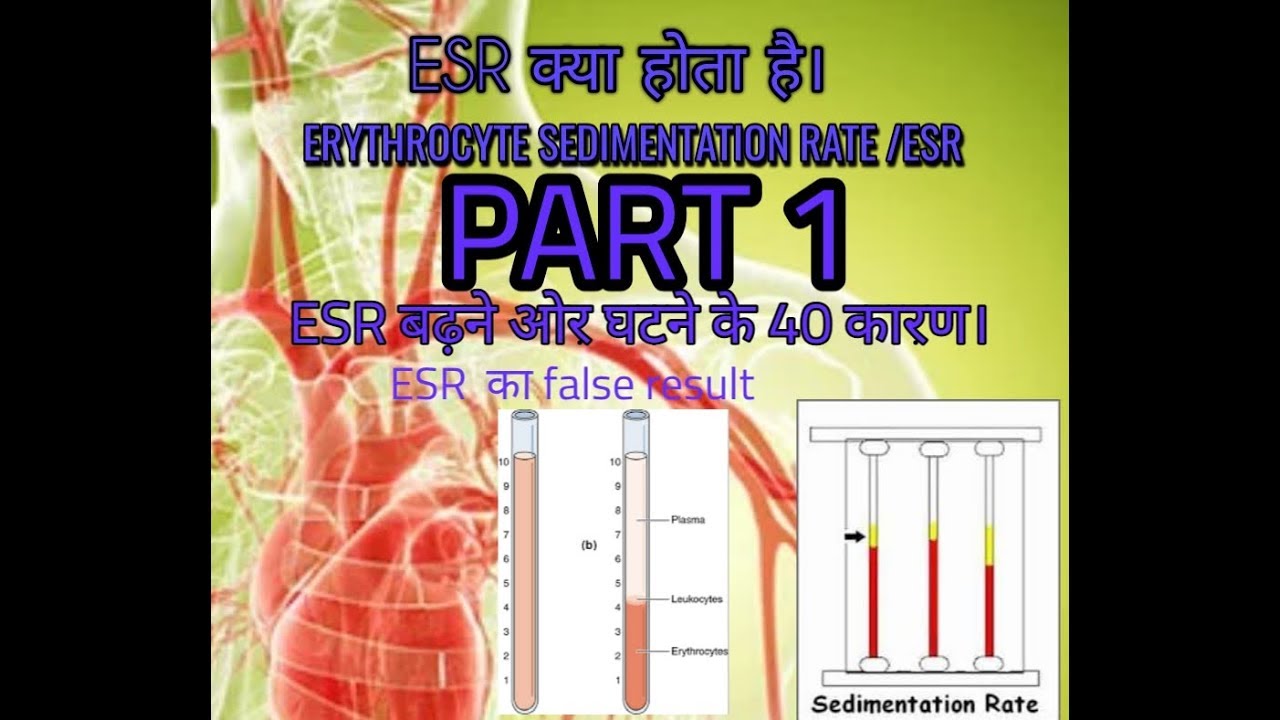 ESR BLOOD TEST|Erythrocyte sedimentation Rate| हिंदी।#esr - YouTube