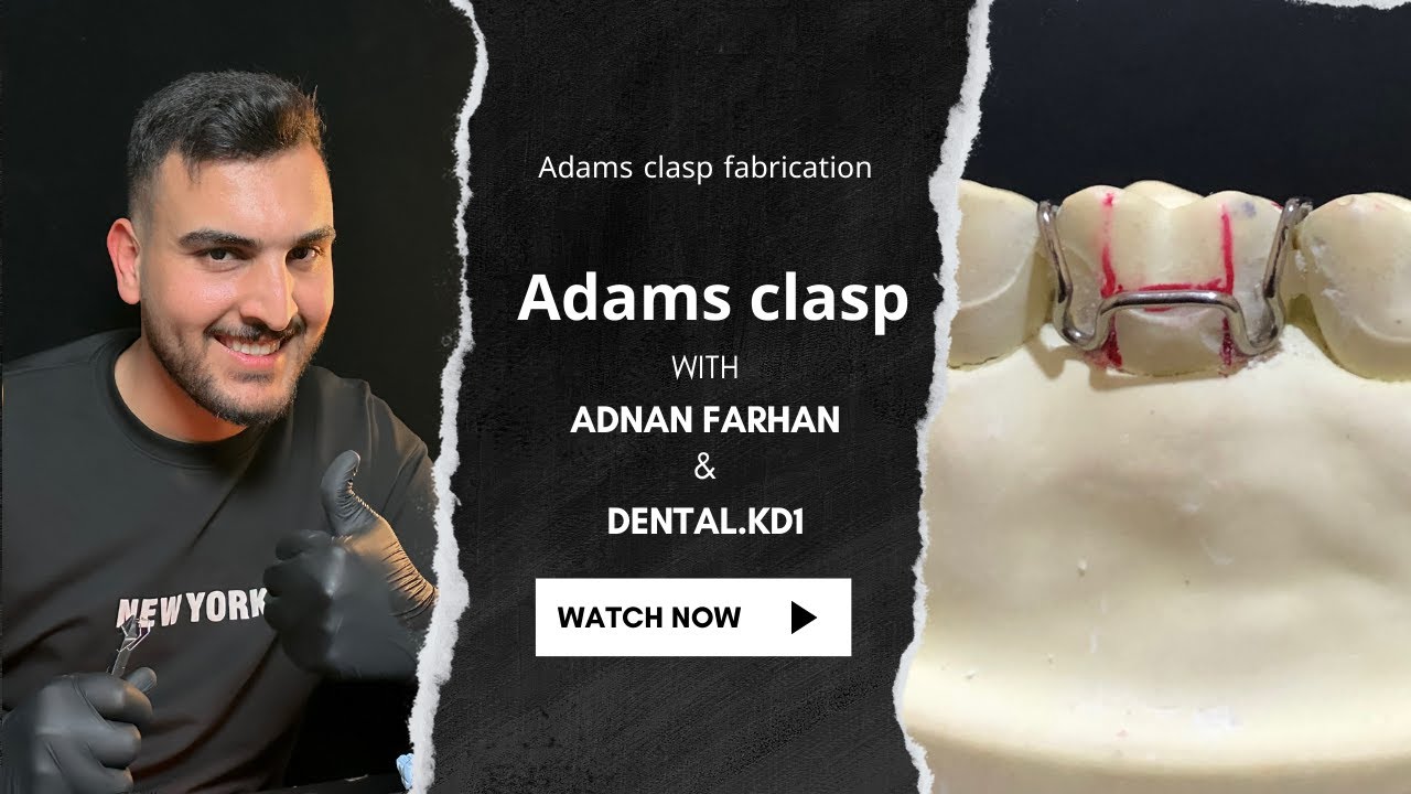 اسهل طريقة لتصميم ادم كلاسب - Adams clasp Adams clasp fabrication - YouTube
