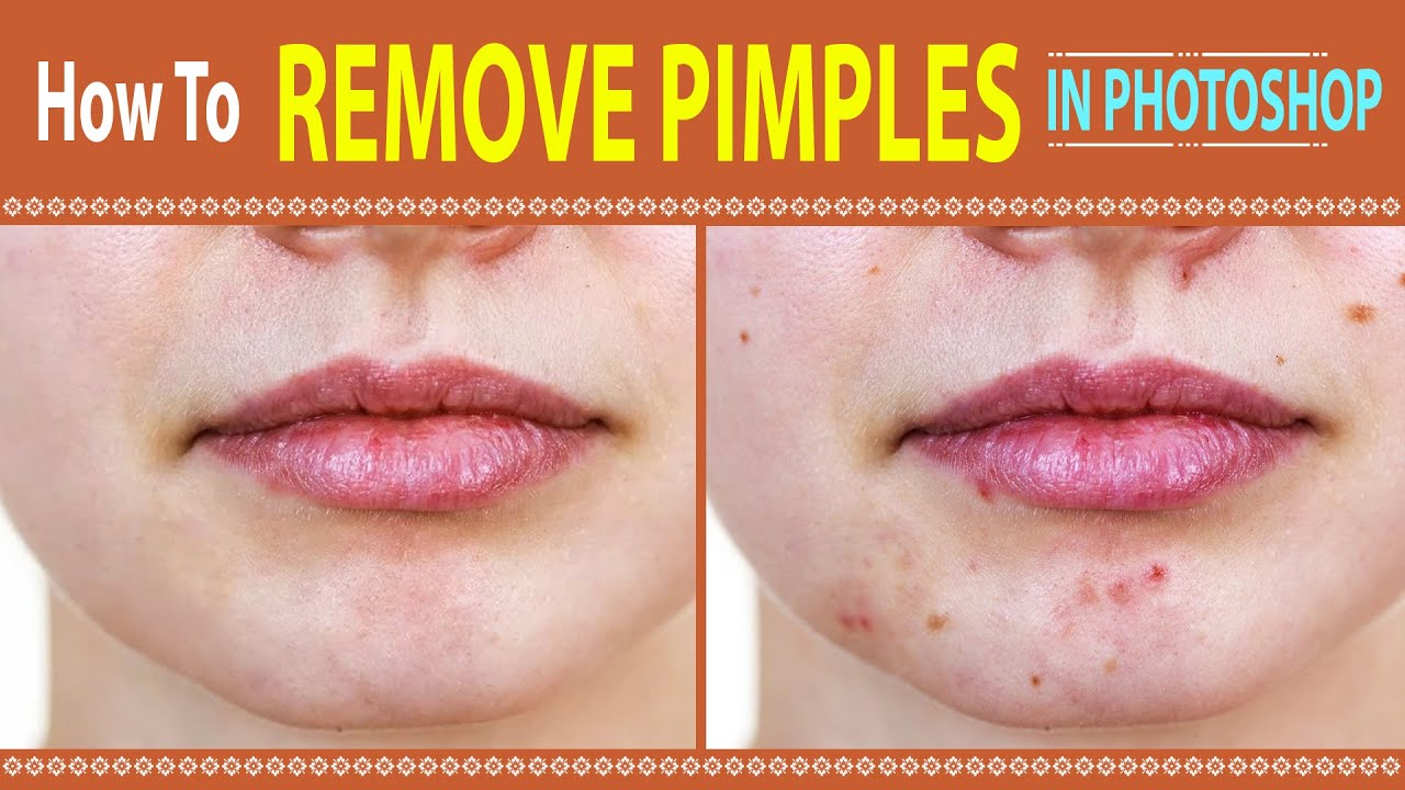 How To Remove Pimples In Photoshop DigiFlamer Learn YouTube how-to-remove-pimples-in-photoshop-digiflamer-learn-youtube