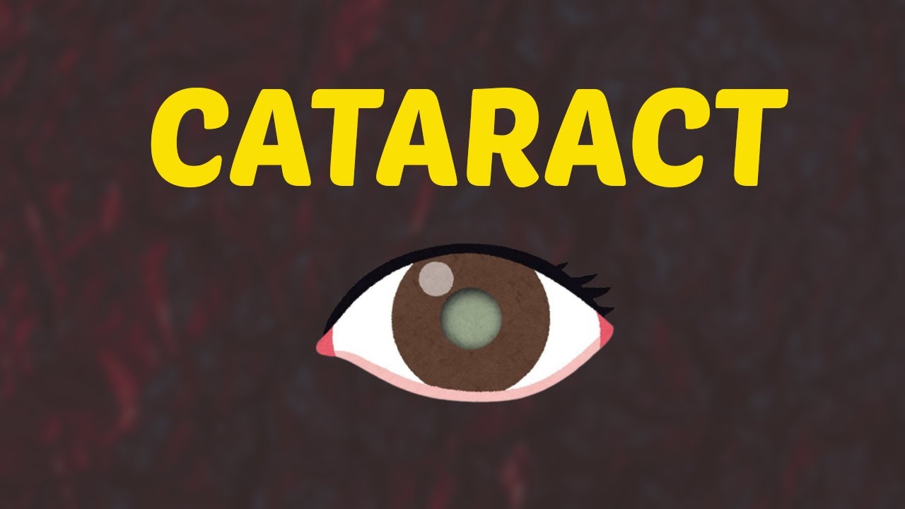 What Does CATARACT Means || Meanings And Definitions in ENGLISH - YouTube