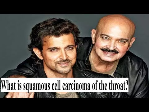Rakesh Roshan has throat squamous cell cancer: What is it?
