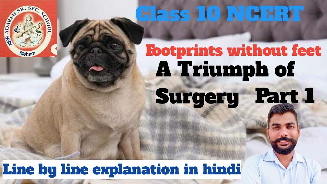 A Triumph Of Surgery Class 10 Summary In Hindi YouTube a-triumph-of-surgery-class-10-summary-in-hindi-youtube