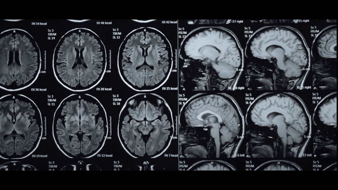 Impact of Right Diagnosis - YouTube