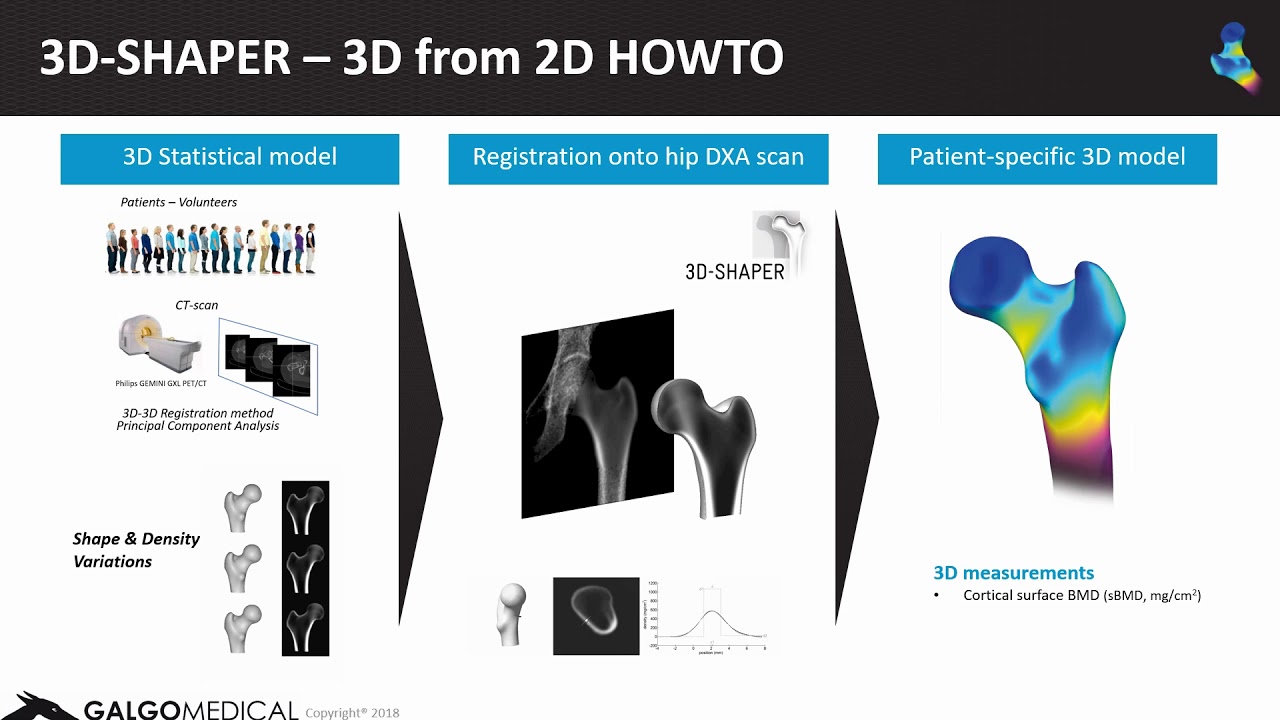 3D-SHAPER® 3D DXA technology | How To get 3D from 2D - YouTube