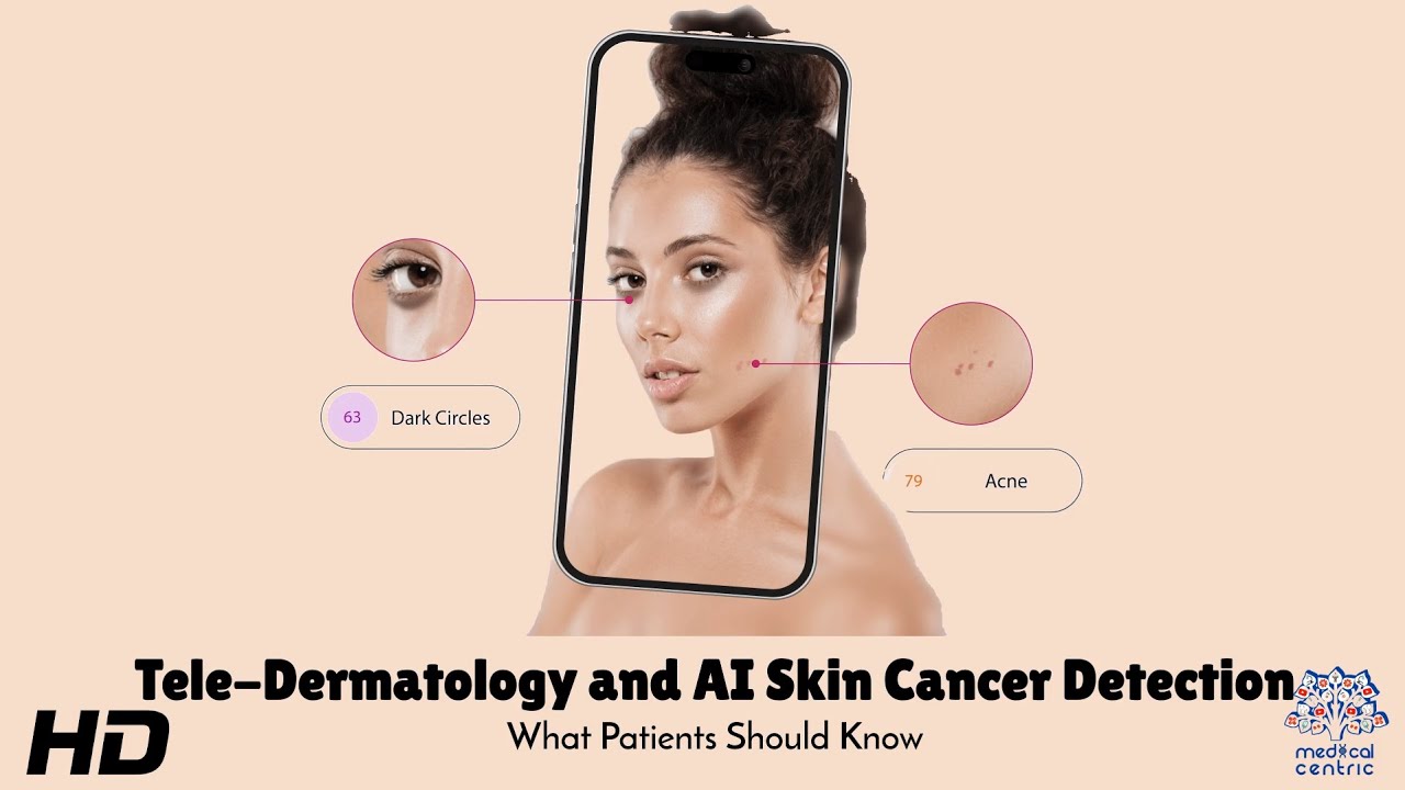 Tele-Dermatology and AI Skin Cancer Detection : What You Need to Know ...