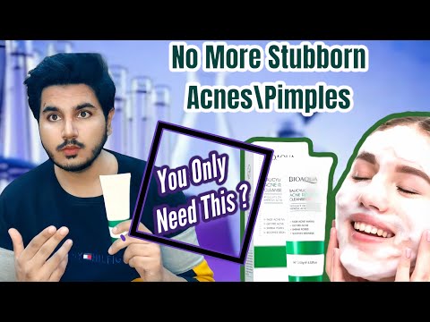 How to Get Rid Of A Stubborn Acne\Pimples - YouTube