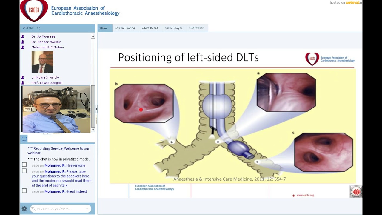 2. Lung isolation tools: A tube or blocker? The DLT is my old friend ...