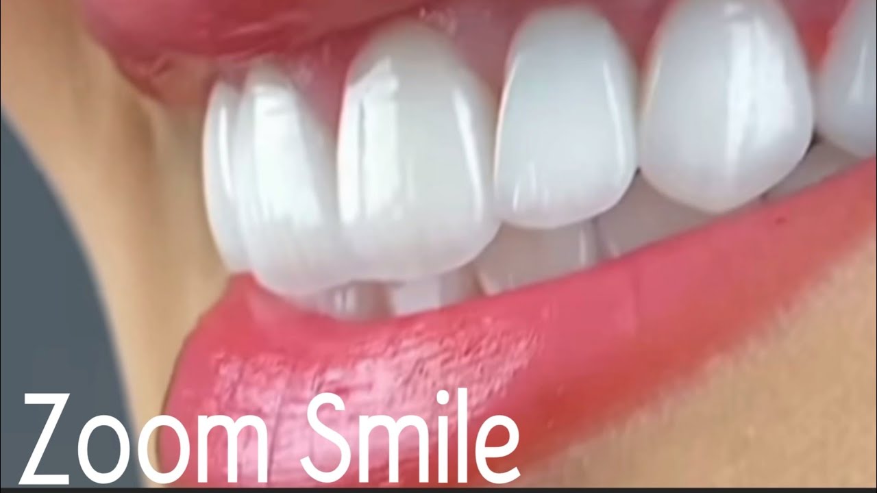 ZOOM Smile Teeth Whitening - YouTube