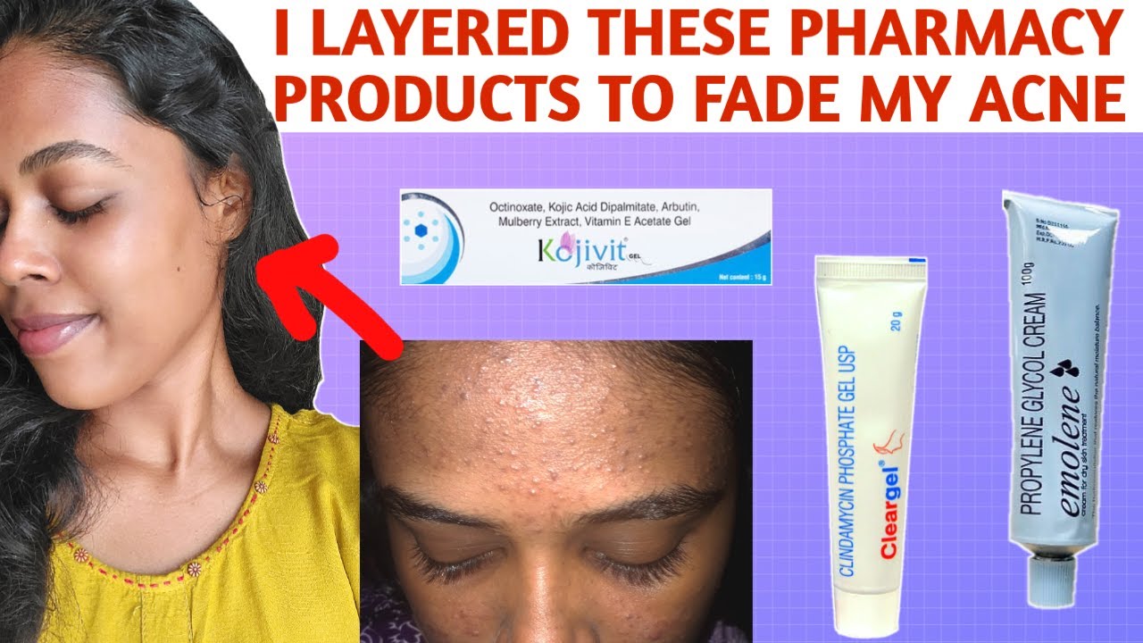 Step by step guide to layer these PHARMACY PRODUCTS to reduce your acne ...