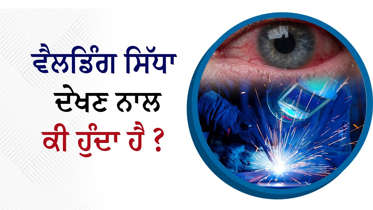 ਵੈਲਡਿੰਗ ਸਿੱਧਾ ਦੇਖਣ ਨਾਲ ਕੀ ਹੁੰਦਾ ਹੈ ? | Dr. Harpreet Eye & Dental Care ...