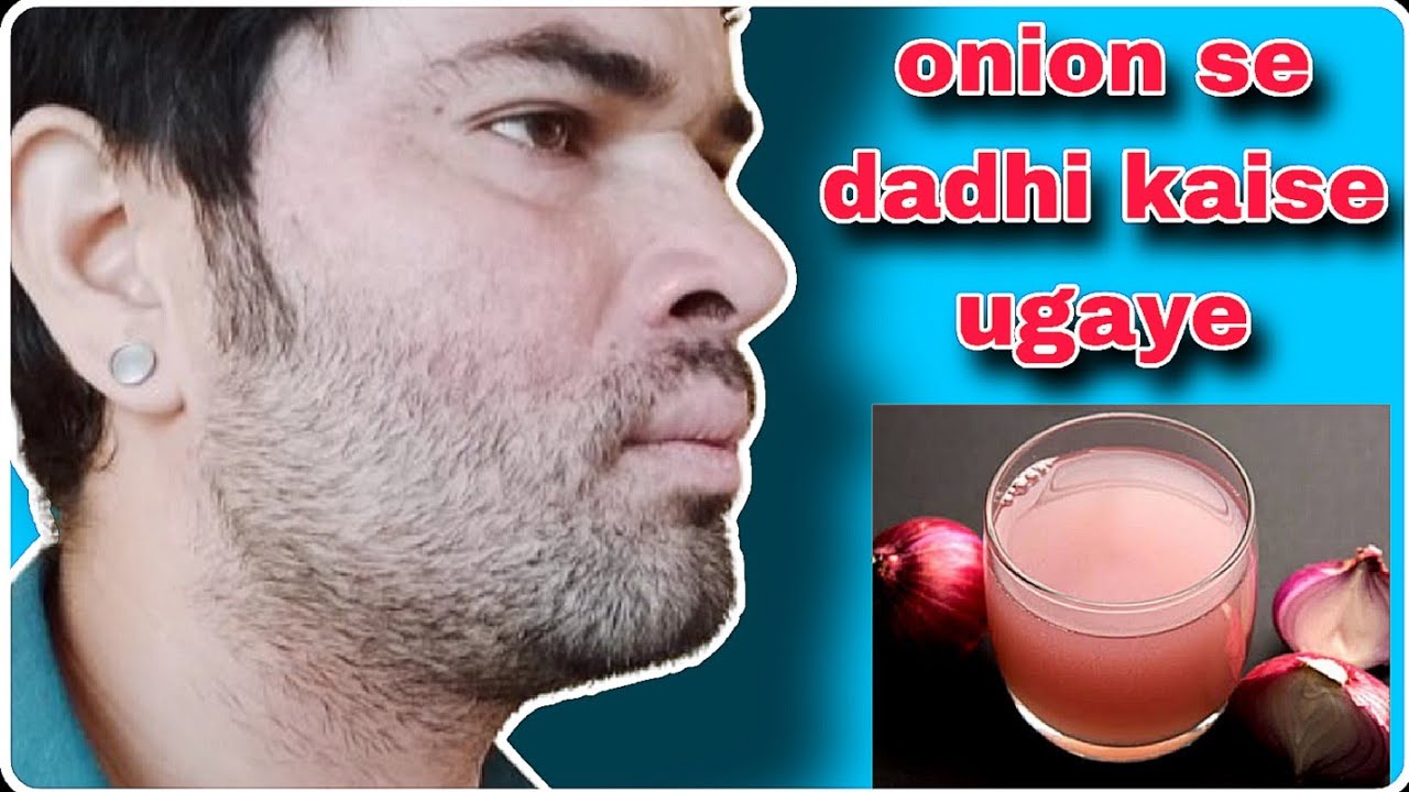 Home made onion oil for beard growth | dadhi kaise ugaye - YouTube