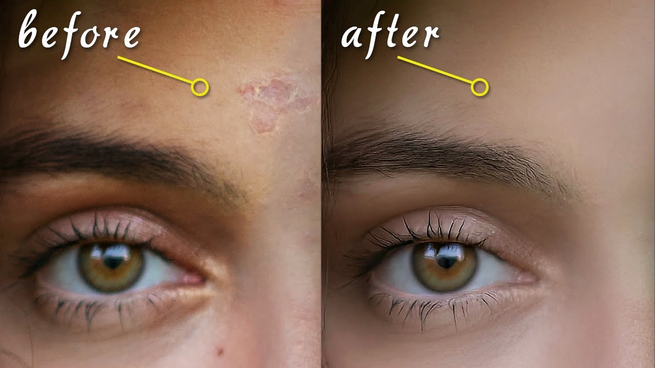 How to retouch skin like a pro in Lightroom - YouTube