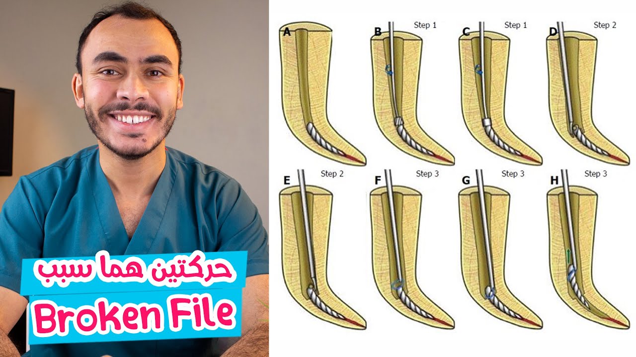 How to Avoid Broken File in 2 Min - YouTube