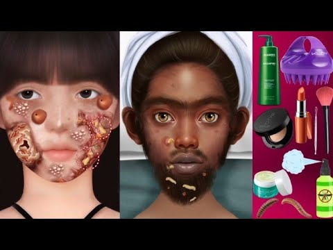 👹DIRTY FACE CLENCING ASMR ANIMATION | WORM REMOVAL | BOY TO GIRL FACE ...