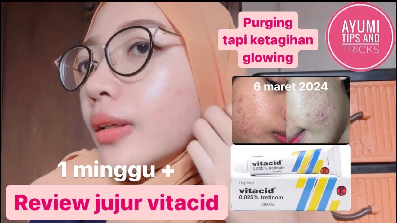 REVIEW VITACID DAN CARA MENGATASI MASALAH VITACID (banyak yang pakai ...