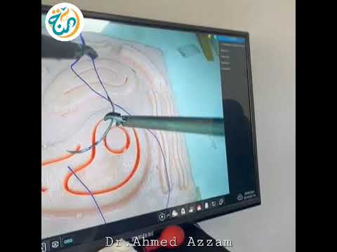 Needle mounting techniques in 3 minutes with voiceover - YouTube