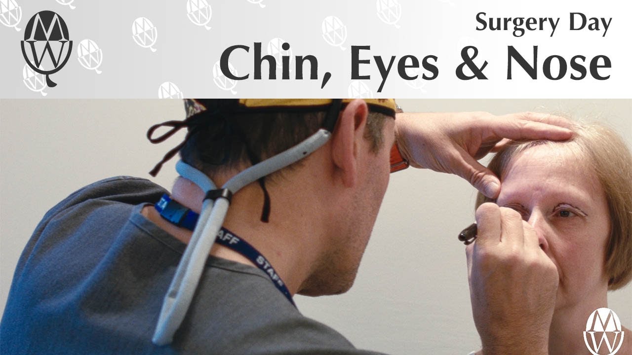 Surgery Day - Chin Eyes and Nose - YouTube