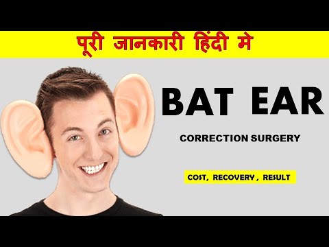 BAT EAR पूरी जानकारी हिंदी मे | Cost, Recovery and Results | Otoplasty ...