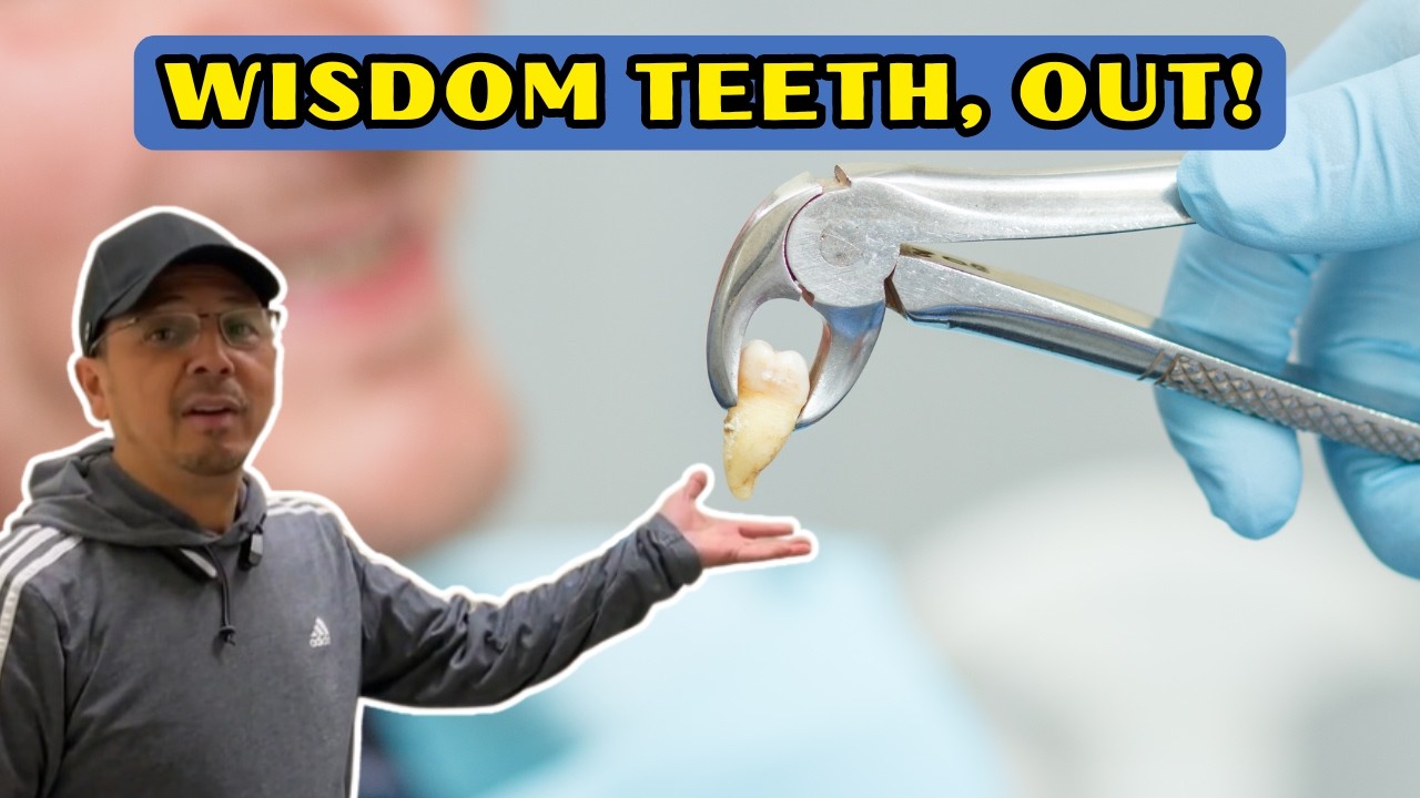 Third Molar Extraction (Wisdom Tooth): What to Expect? | View Mobile ...