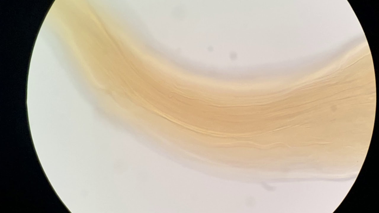 Heterakis gallinarum (fêmea) - YouTube