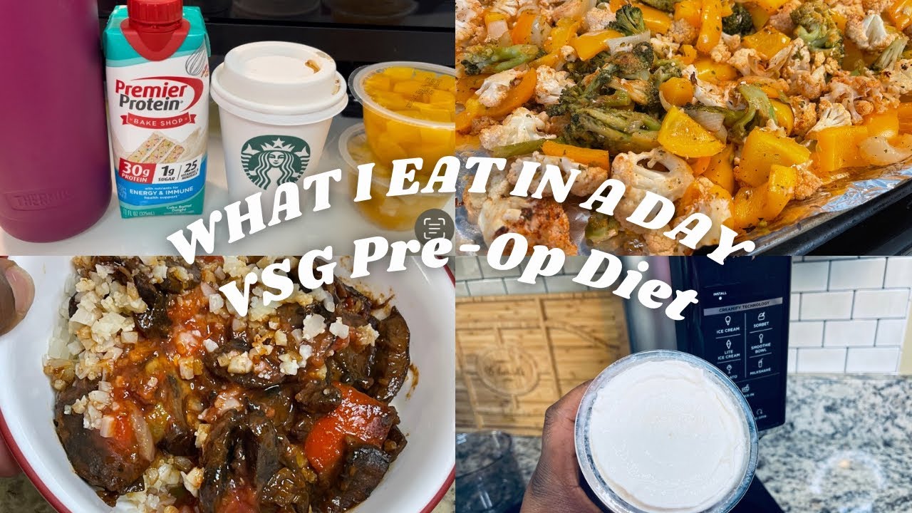 VSG Journey | VSG Surgery | Pre-Op Diet Day 8 | Bariatric Surgery ...