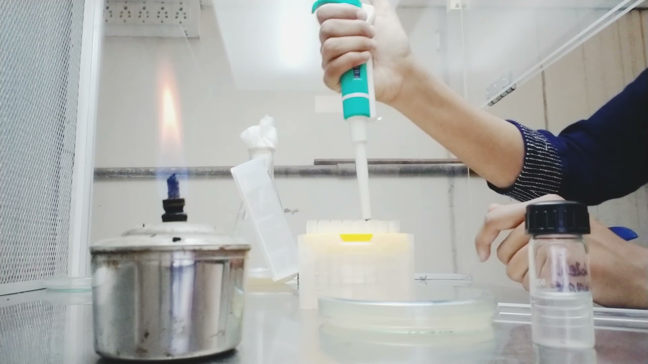 Bacteria present in water | Standard plate count method | Isolation of ...