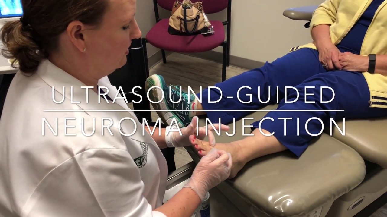 Lexington Podiatry Ultrasound Guided Neuroma Injection Youtube
