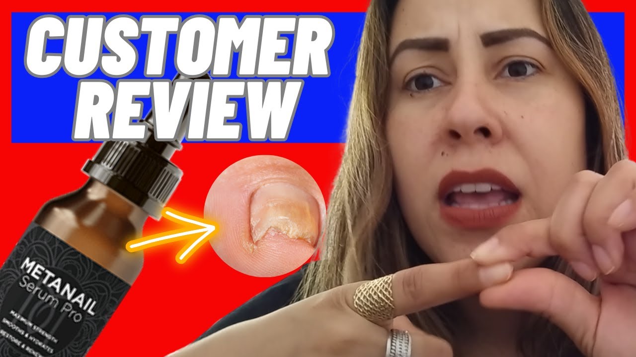 METANAIL COMPLEX ⚠️WARNING!⚠️ METANAIL SERUM PRO - METANAIL COMPLEX ...