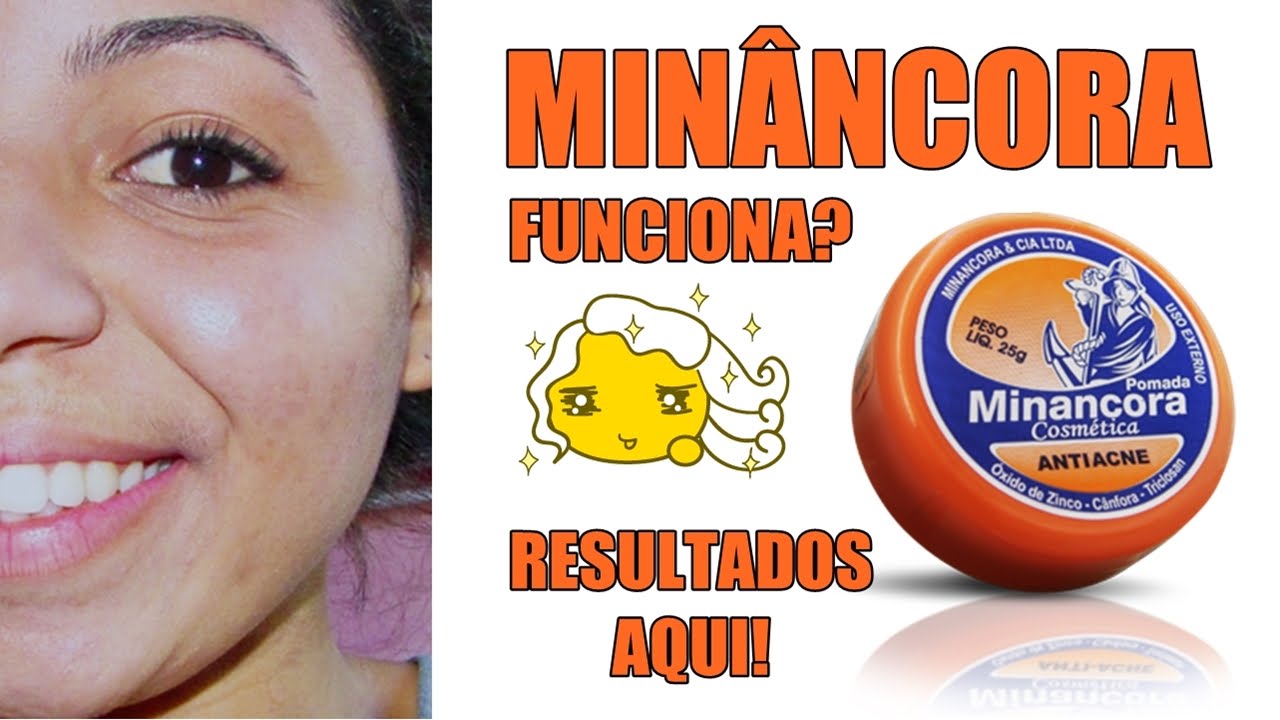 DEPOIS DA MINÂNCORA - RESULTADOS - YouTube