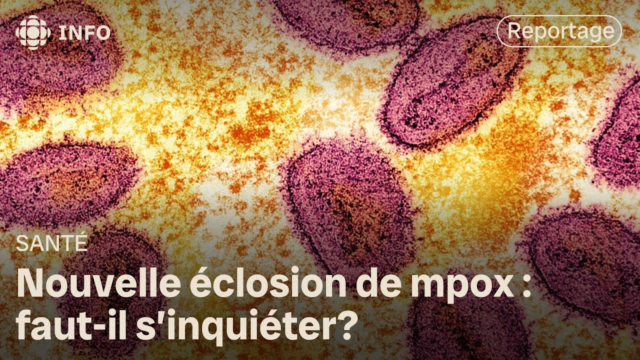 Les risques associés à la mpox analysés par des experts - YouTube