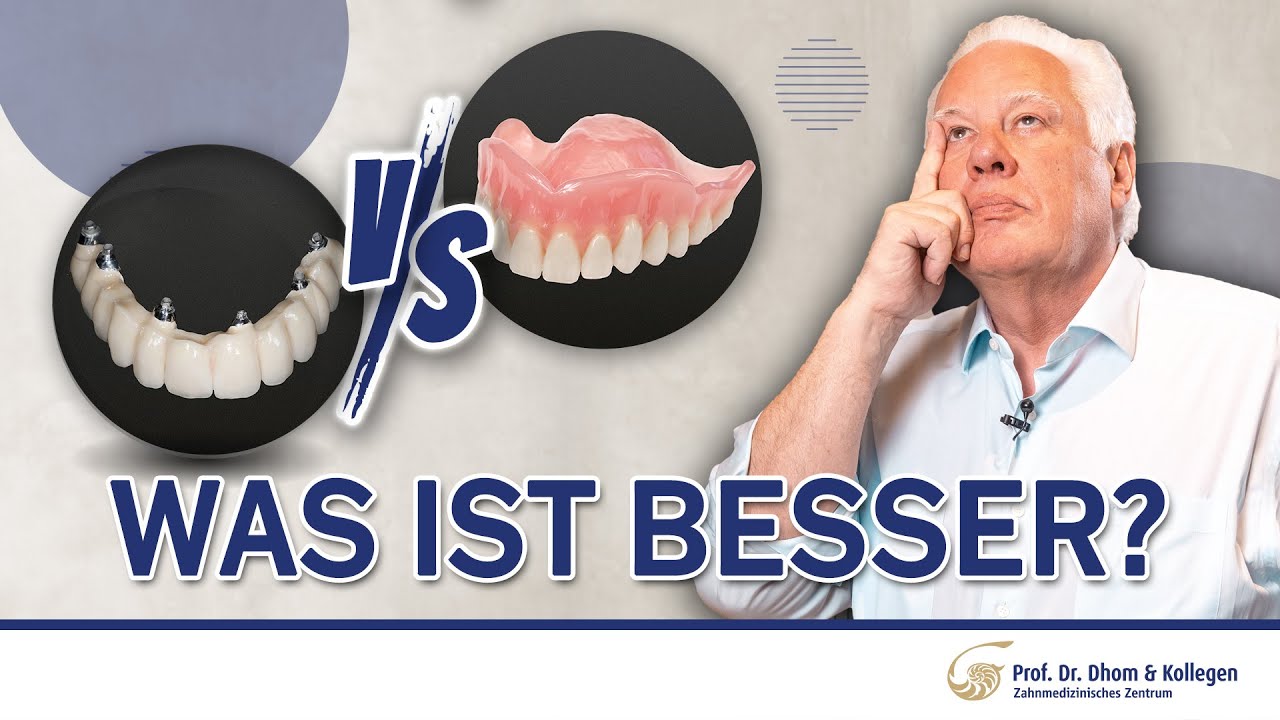 Fester oder herausnehmbarer Zahnersatz? Das musst du wissen! - YouTube