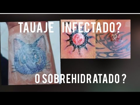 Tu tatuaje está infectado o sobrehidratado ? - YouTube