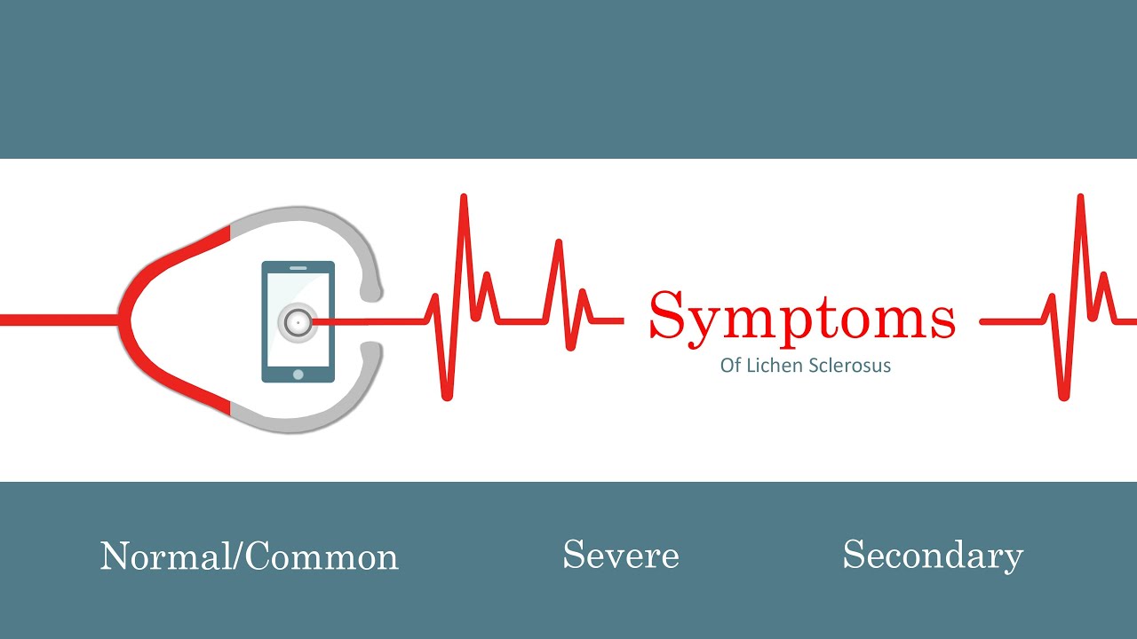Lichen Sclerosus Symptoms - YouTube