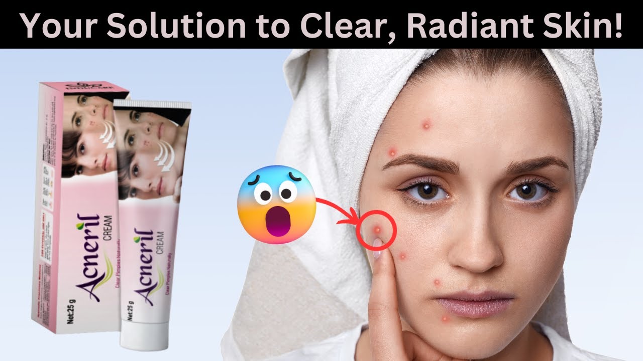 Acneril Cream - Your Solution to Clear, Radiant Skin! - YouTube