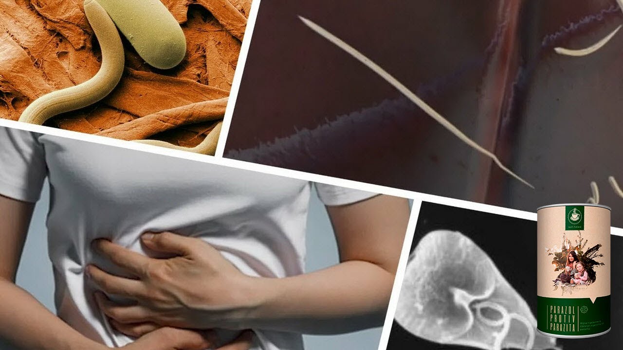 Parazol Caj Kako Se Koristi - YouTube