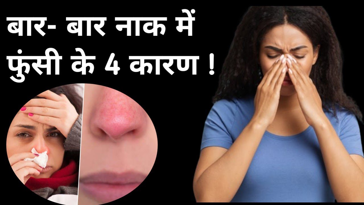 Inside Nasal Wall Boil