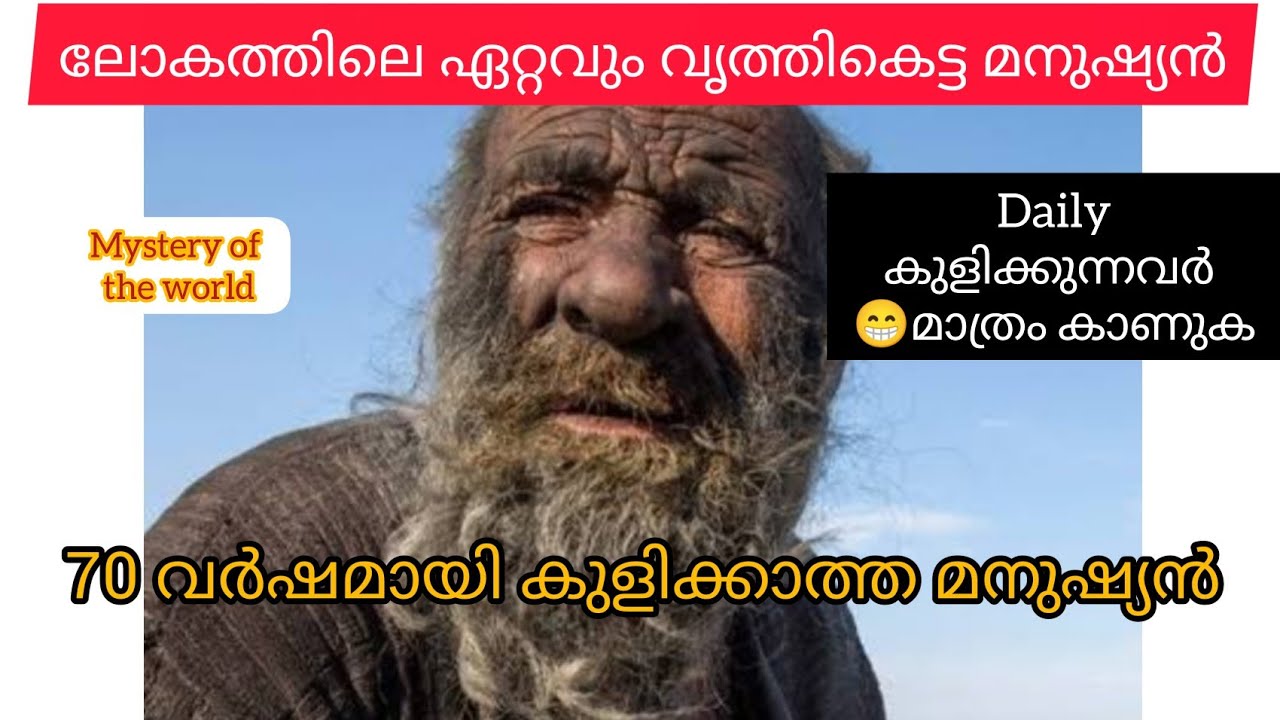 ലോകത്തിലെ ഏറ്റവും വൃത്തികെട്ട മനുഷ്യൻ|| Amou Haji Malayalam||World's ...