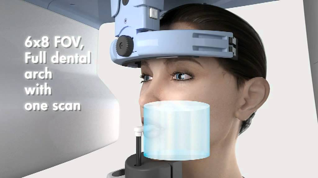 ORTHOPANTOMOGRAPH® OP300 - Instrumentarium Dental - YouTube