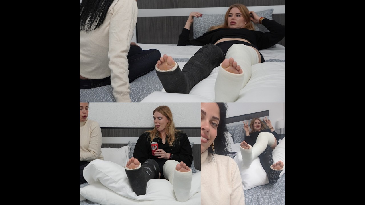 Both Legs in Cast | Double Leg Cast Experience & Close-Ups (full video ...