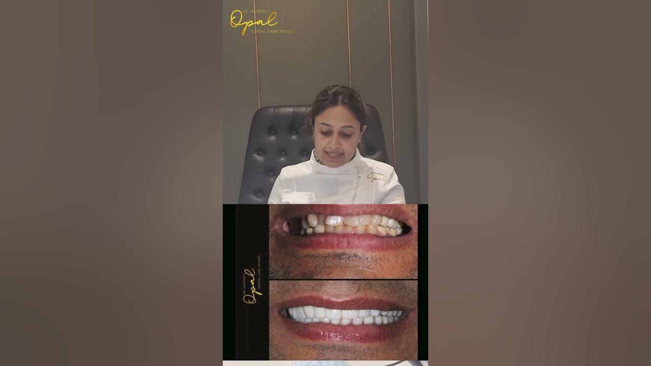 Opal Dental Care Studio | International Patient Full Mouth Reconstruction Case Study. - YouTube