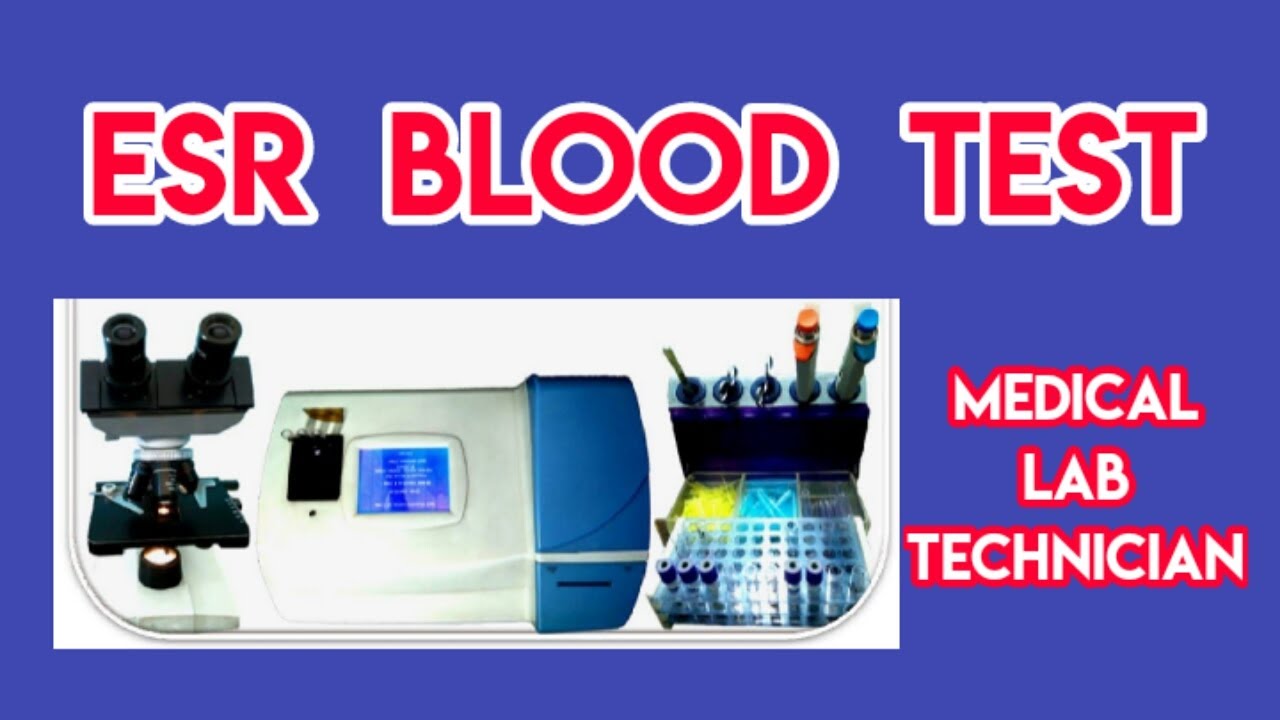 ESR Test Procedure | What is est Test | Esr Test for cancer | Esr Lab ...