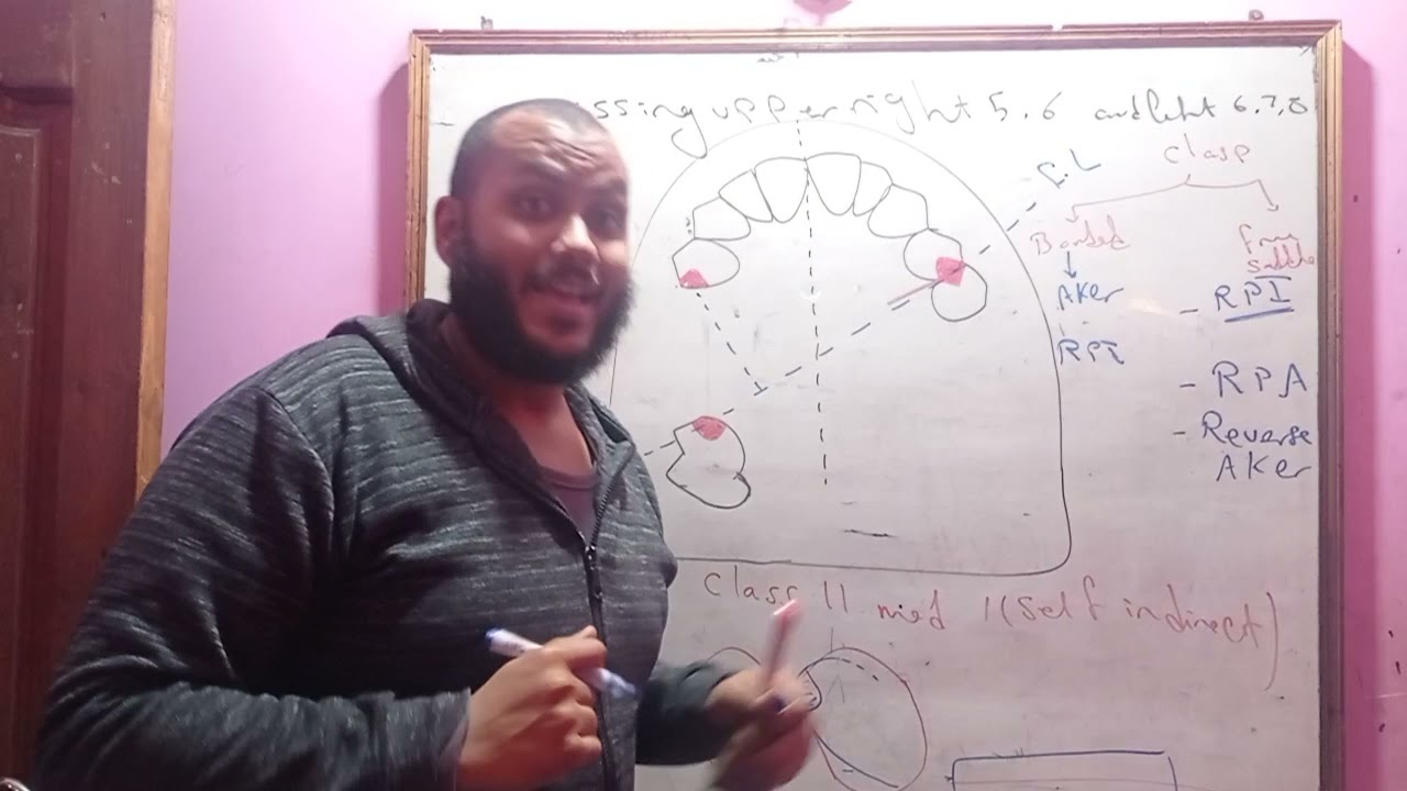 class I I mod 1 - YouTube