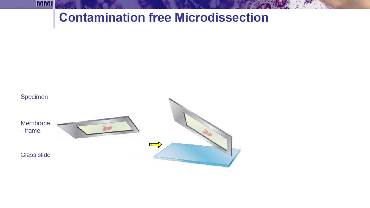 Laser Microdissection: MMI CellCut - YouTube