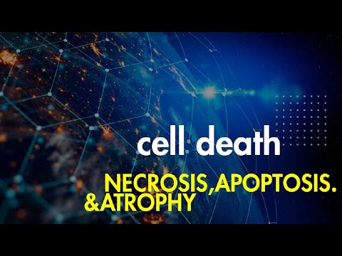 cell death # necrosis, Apoptosis and Atrophy - YouTube