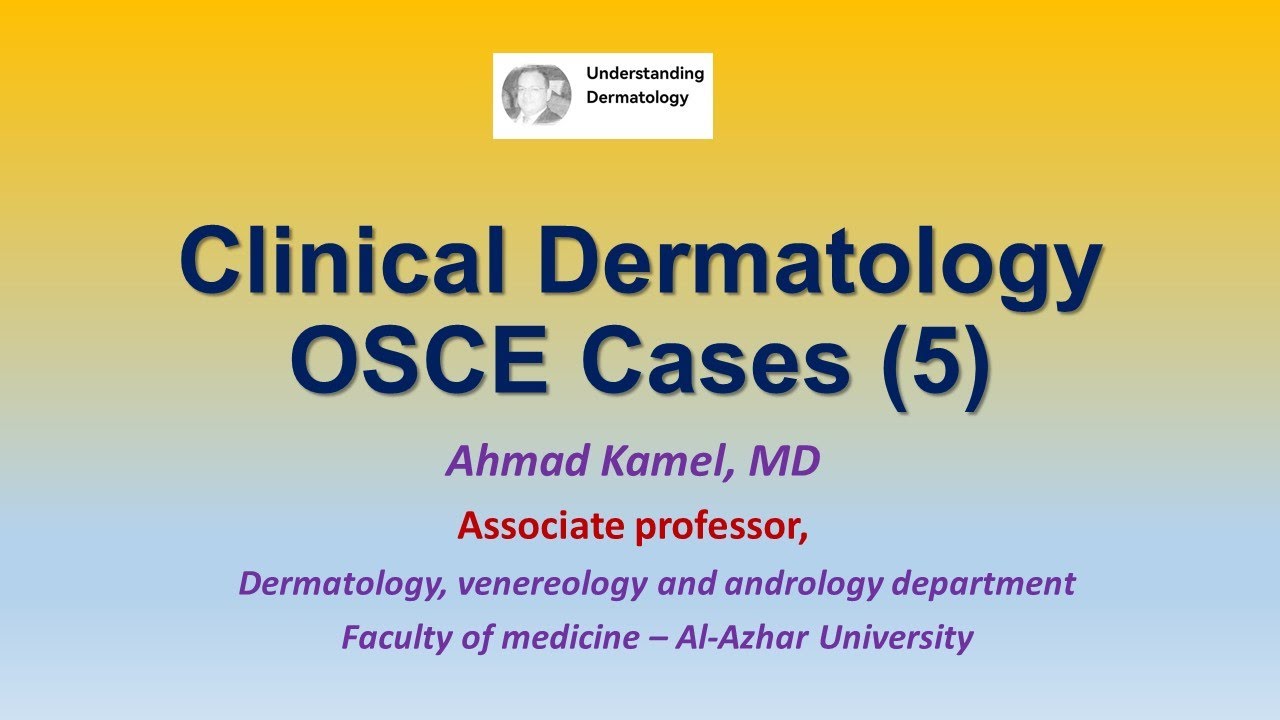 Clinical Dermatology OSCE Cases 5 - YouTube