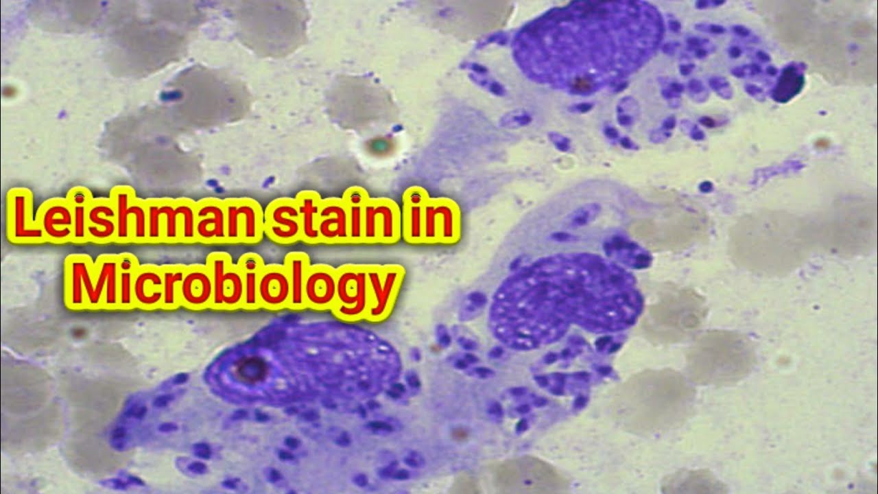 Leishman staining technique: staining in microbiology lecture 3 - YouTube