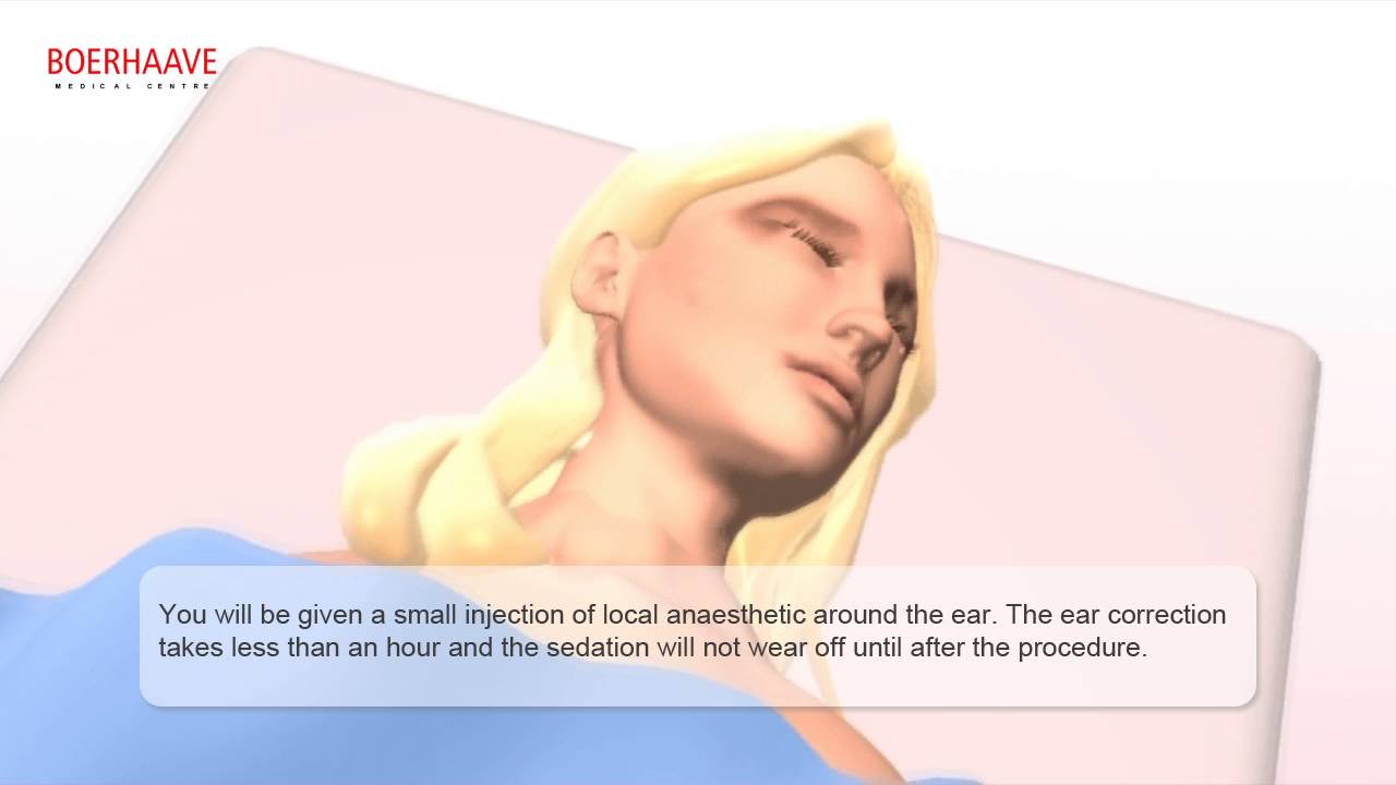 Ear Correction Animation - Boerhaave Medical Centre - YouTube