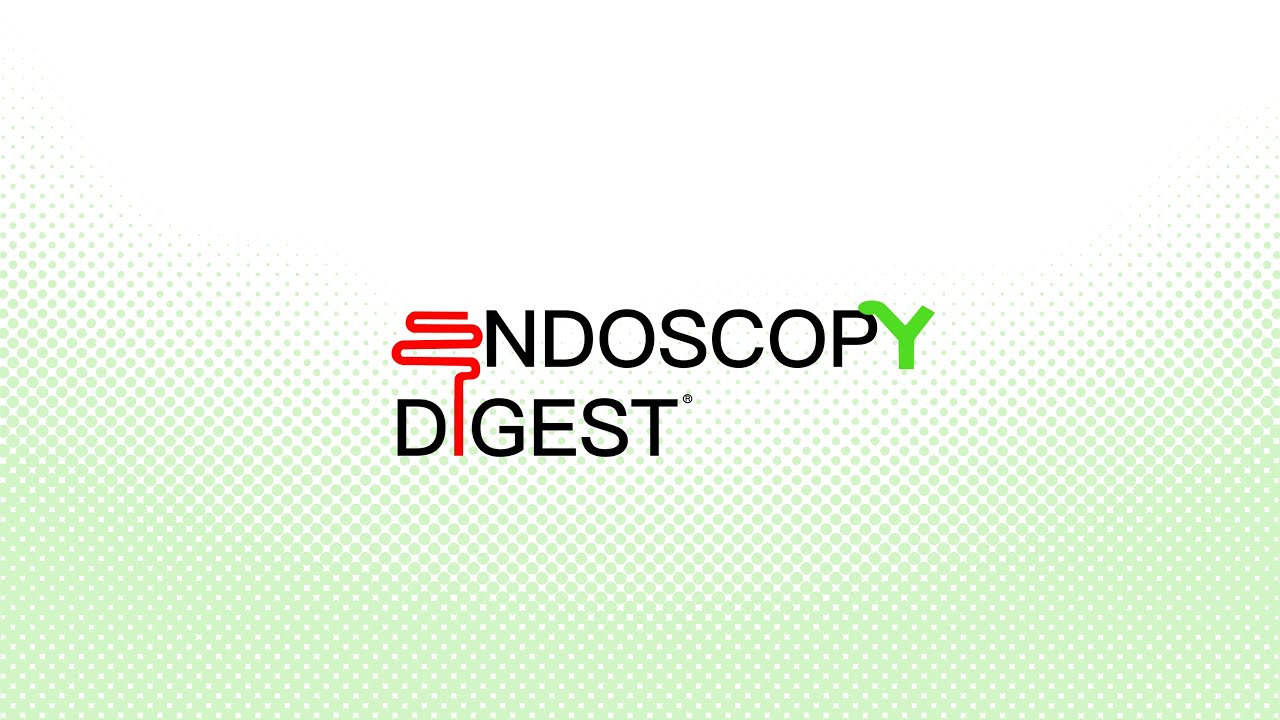 EUS guided Common Bile Duct Drainage and Gastro-Entero Anastomosis in ...